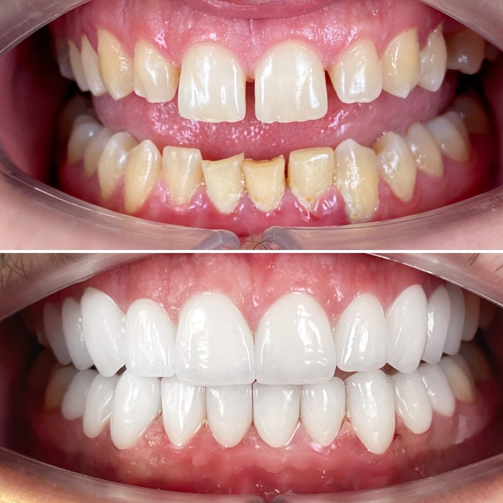 Dentist në Prishtinë - Klinika Dent Mex